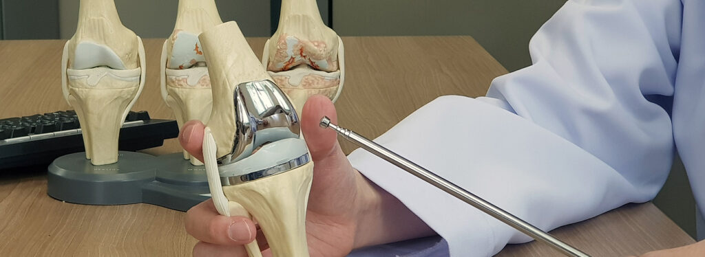 Totalprotes | Artroscenter